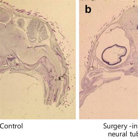 Mid Sagittal Sections Of The Posterior Fossa In A Control Embryo Download Scientific Diagram