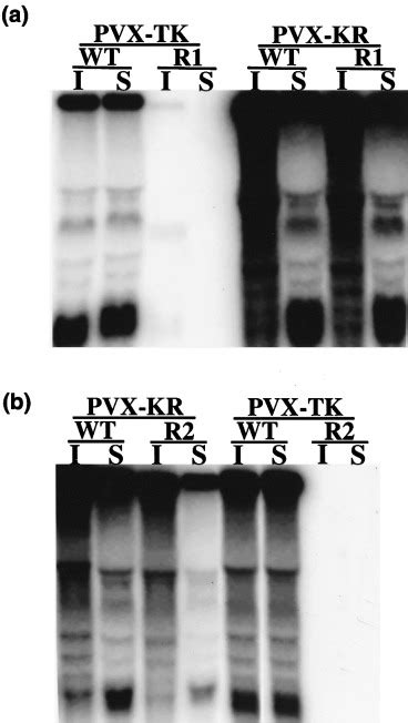 Gel Blot Analysis Of Pvx Rna Accumulation In Ac15 Transgenic Download Scientific Diagram