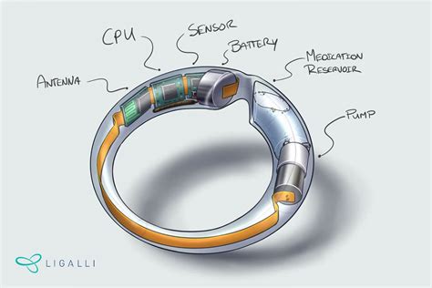 Vaginale Ring Helpt Bij Aanpak Incontinentie Vrouwen Patientempowerment Nl