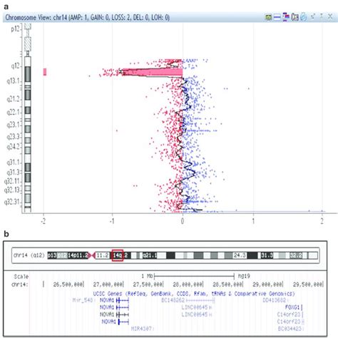 Array Cgh Analysis Detected A 409 Mb Loss Of The Copy Numbers In The