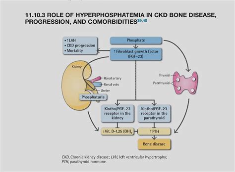 Basem Askar On Linkedin Hyperphosphatemia And Ckd Basem Askar On Linkedin Hyperphosphatemia And Ckd