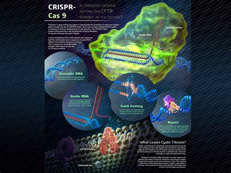 M1 And M2 Segments Of The Middle Cerebral Artery Ami 2017 Annual Conference