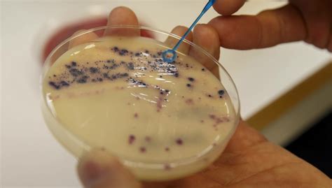 The Strange And Deadly Consequences Of Bacterial Sex