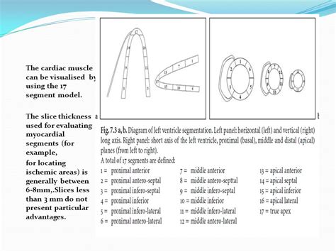 Cardiac Mri Basics And Role In Coronary Artery Disease Ppt Download