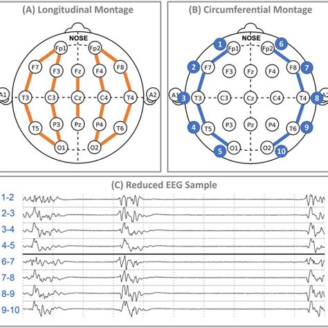 full montage and reduced montage electroencephalogram construction