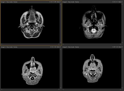 how easy dicom viewer is different yohz software development blog