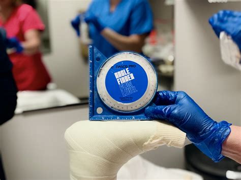 Dynamic Serial Casting — Pediactivity