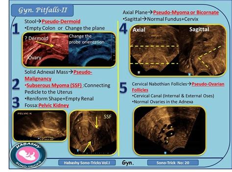 Пин от пользователя Cyuce на доске Nursing