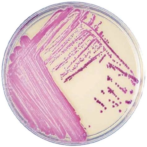 Isolation And Identification Of Staphylococcus Aureus Microbial Notes