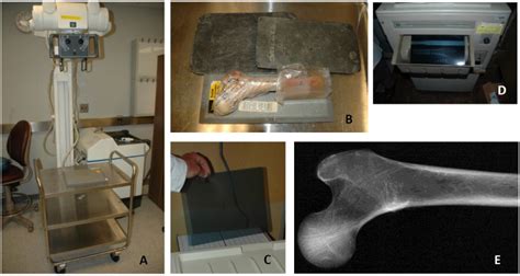 Proximal Cadaveric Femur Preparation For Fracture Strength Testing And
