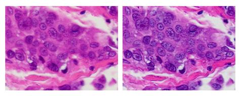 6 Ways Modern Color Microscope Cameras Improve Clinical Research Olympus Ls