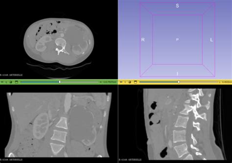 Test Dicom To Nrrd Democratiz3d® Processing