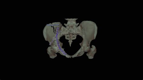 pelvis segmentation 3d model by cmkellaway [1480d82] sketchfab