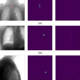 Example Outputs Produced By Our Network A B C Represent Spinous Download Scientific Diagram