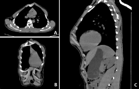 CT Examination Images Before Operation Download Scientific Diagram