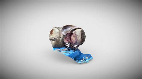 Craniotomy Download Free 3d Model By Neurosurgeon93 [10be774] Sketchfab