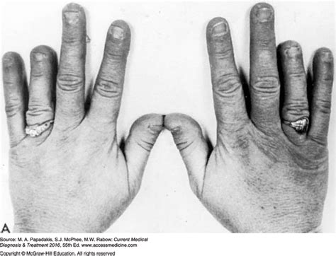 Accessmedicine Cmdt Media Library