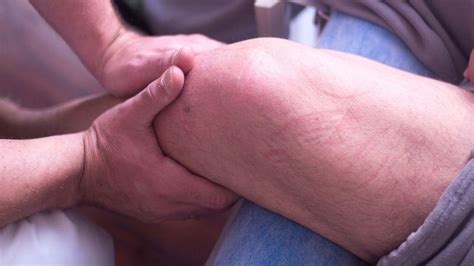 Manual Therapy Cpt Code 97140