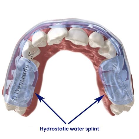 Aqualizer Immediate Help For Tmd Complaints Dentrade