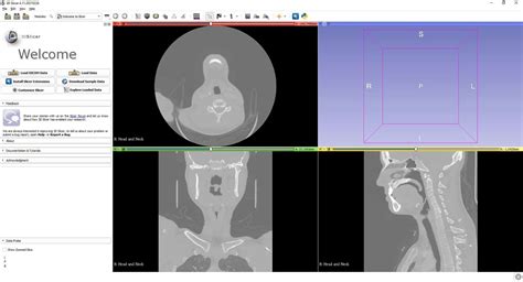 How To Convert Nrrd File To Dicom For 3d Printing Medimodel