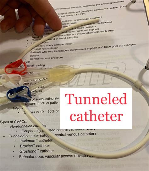Non Tunneled Central Venous Catheter