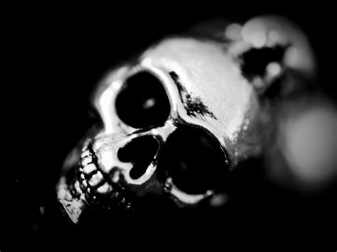 Why Scalp Hematoma And Bruising Indicate A Serious Problem Hubpages