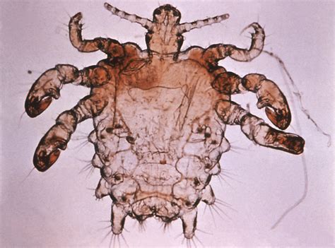Lice Public Health And Medical Entomology Purdue Biology Entomology Insects Ticks