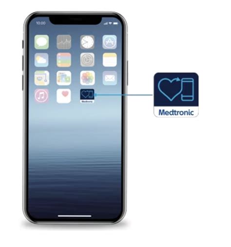 How To Send A Manual Transmission With Medtronic Vector Remote Care