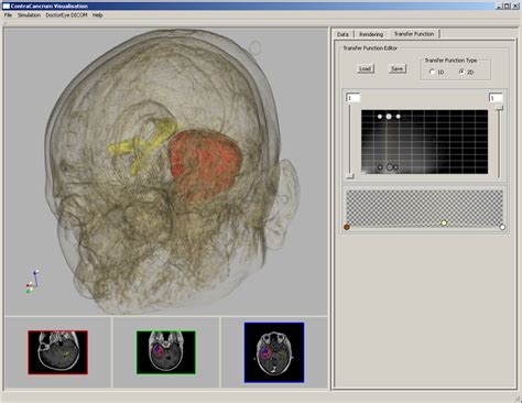 Hybrid 2d Transfer Function Based Volume Rendering With Isosurface Download Scientific Diagram