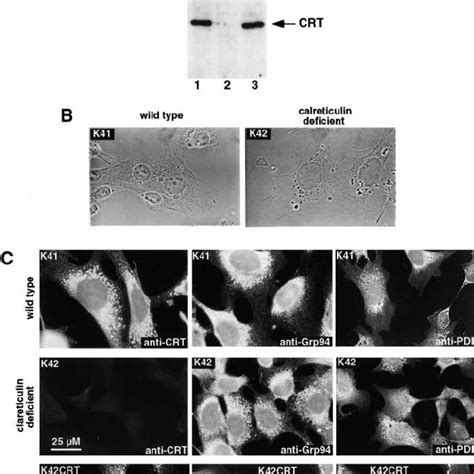Calreticulin Deficient Mouse Embryonic Fibroblasts A Western Blot Download Scientific