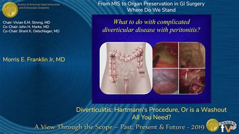 Laparoscopic Colon Resection And Colostomy With Hartmann