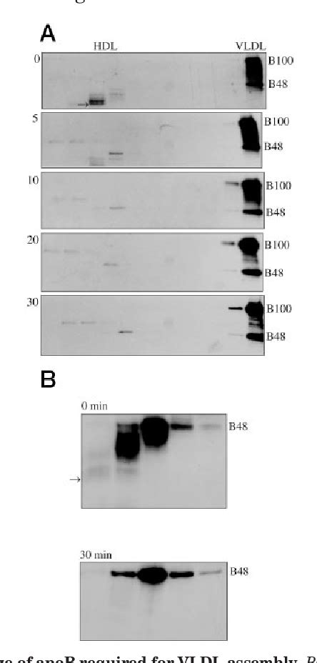 Figure 3 From The Assembly And Secretion Of Apolipoprotein B 48 Containing Very Low Density