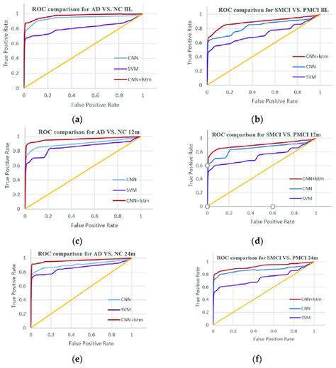 comparison of the roc curves of different algorithms a comparison of