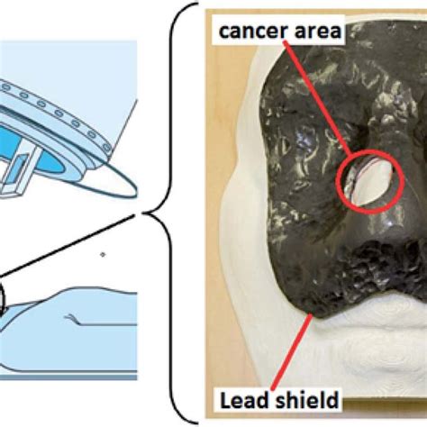 A Tdds Patch B Structure Of A Tdd Patch C Drug Diffusion Within Download Scientific