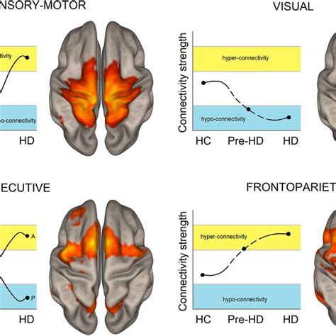 Pattern Of Aberrant Connectivity In The Sensory‐motor And Visual