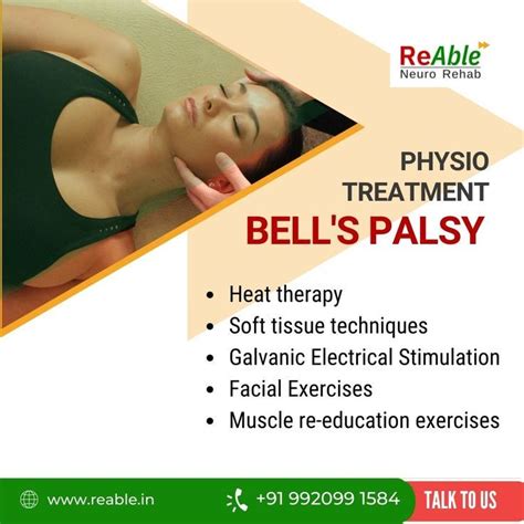 Bell S Palsy And Its Treatment Artofit