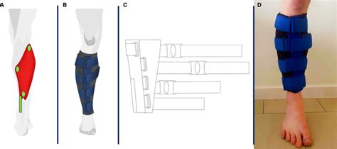 Diagrammatic Representation Of A The Anatomical Locations Of The Download Scientific Diagram