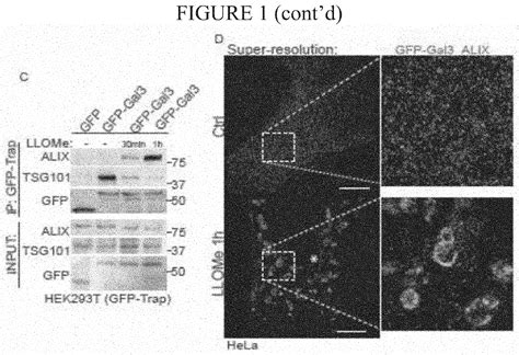 Galectin 3 Governs And Coordinates Escrt And Autophagic Responses