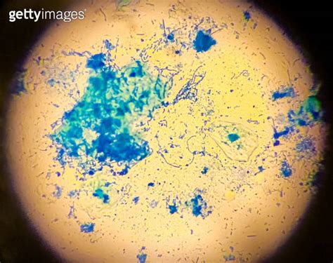 Bacterial Cells Chains Streptococcus Pyogenes Photo From Microscope 이미지 2161635894 게티이미지뱅크 Bacterial Cells Chains Streptococcus Pyogenes Photo From Microscope 이미지 2161635894 게티이미지뱅크