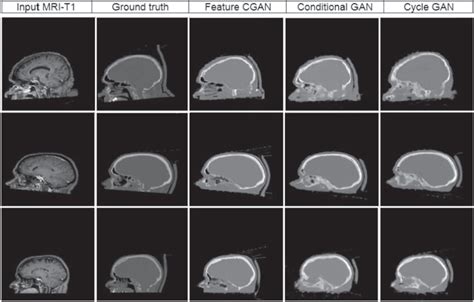 Ct Synthesis Comparison On The Ds2 Dataset From Left To Right Input Download Scientific