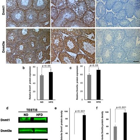 Effect Of Hfd On Global Dna Methylation With 5mc Staining In Mouse