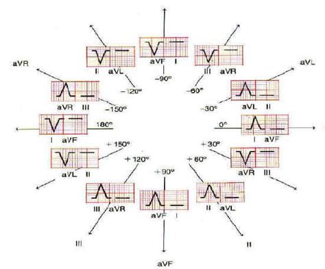 Ecg Educator Blog Artofit Ecg Educator Blog Artofit