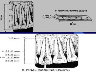 LENGTH DETERMINATION Ppt