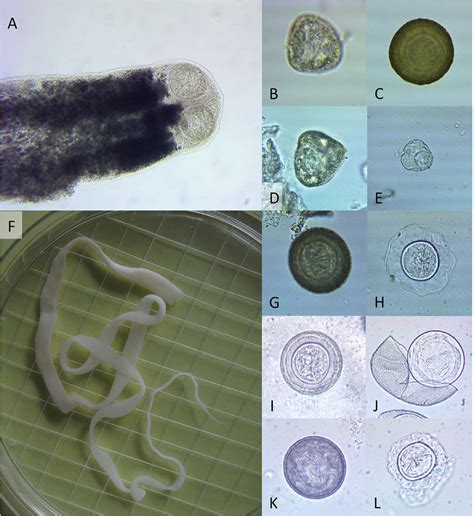 Examples Of Cyclophyllidean Tapeworms And Eggs Recovered From Apodemus