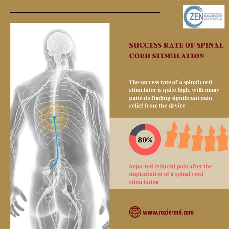 Spinal Cord Stimulator To Ease Your Daily Life In Mansfield Tx
