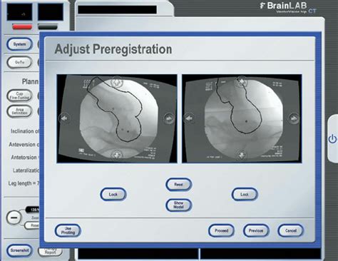 fluoroscopically guided navigation using ‘ cross matching of online