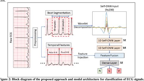 Figure 2 From Global Ecg Classification By Self Operational Neural Networks With Feature