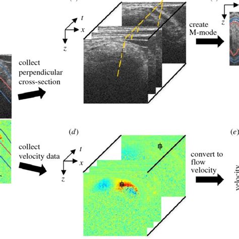 Flow Chart Of Oct Image Analysis A Flow Angle Was Measured By First