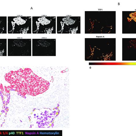Rapid Brightfield Multispectral Imaging Of Nsclc 4 Plex Plus Download Scientific Diagram