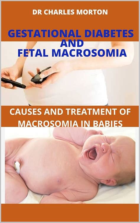 Gestational Diabetes Treatment